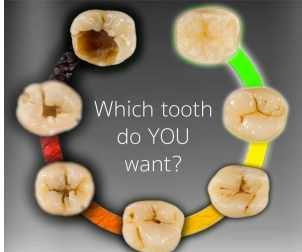 Candy That Really Fights Cavities