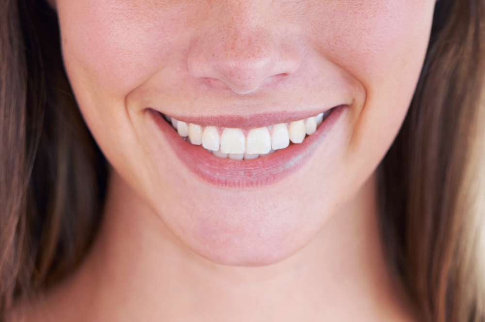 Anatomy of a Smile Makeover: A Comprehensive Guide to Getting a Better ...